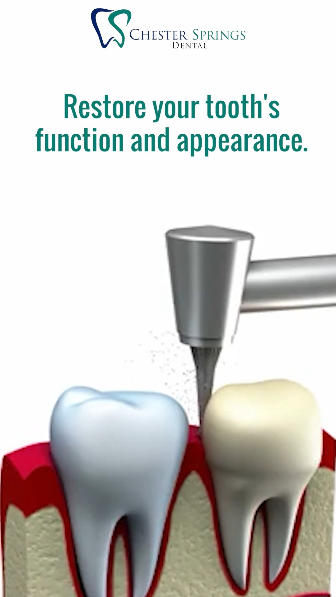 Dental Health - Chester Springs Dental | Exton, PA